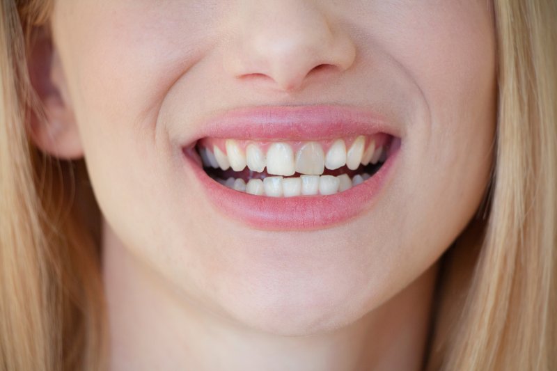 Causes & Solutions For Gray Teeth | Alberto J. Lamberti, D.M.D.